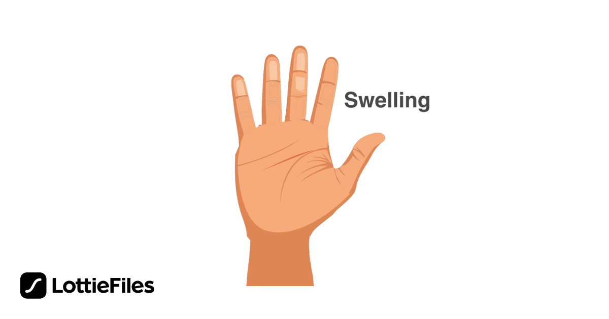 Free Acute inflammation hallmarks/symptoms Animation by Joana Barreira ...