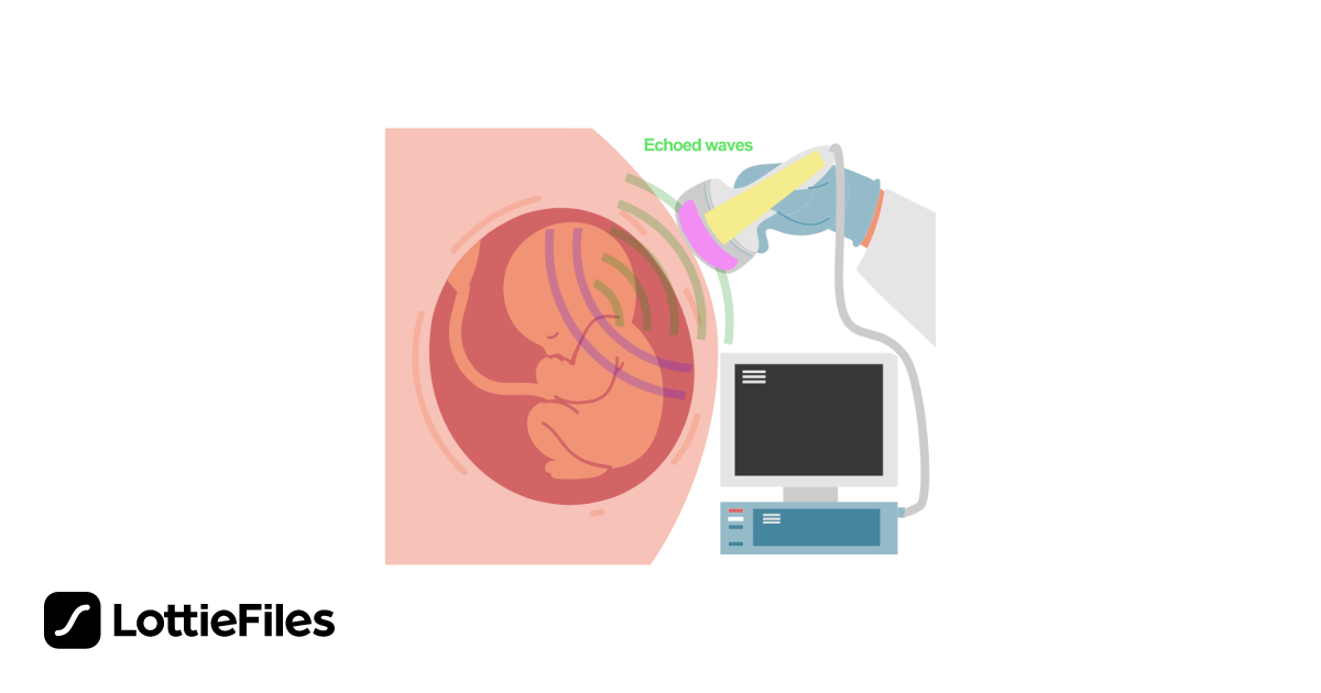 Free Ultrasound general basics Animation by Joana Barreira | LottieFiles