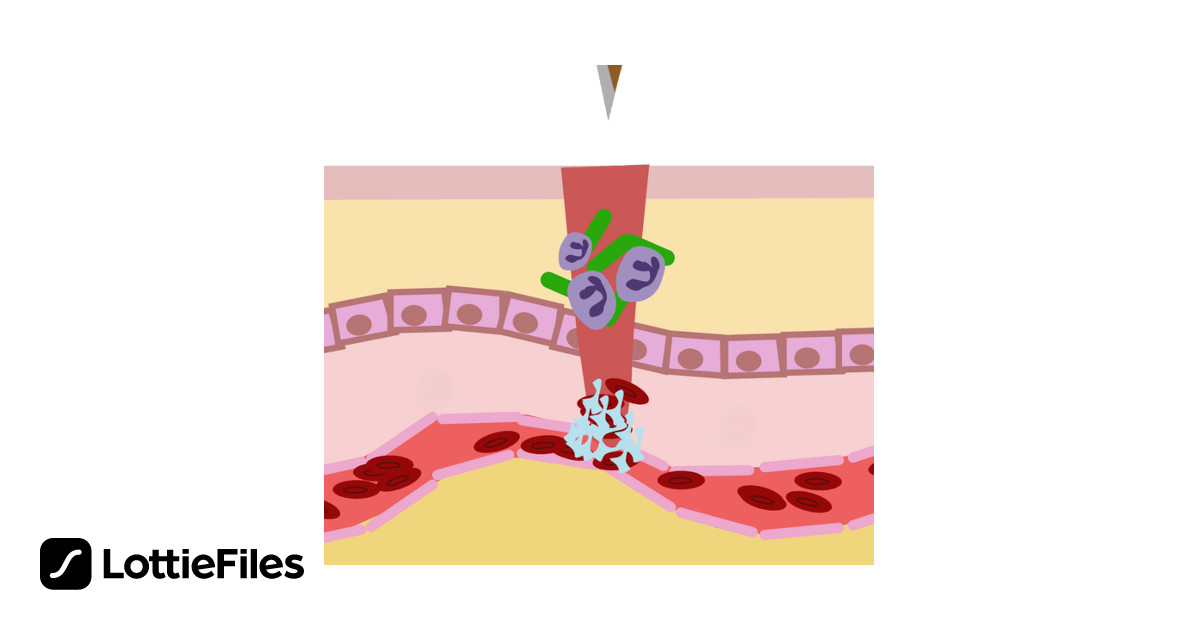 Free Accute inflammation nail Animation by Joana Barreira | LottieFiles