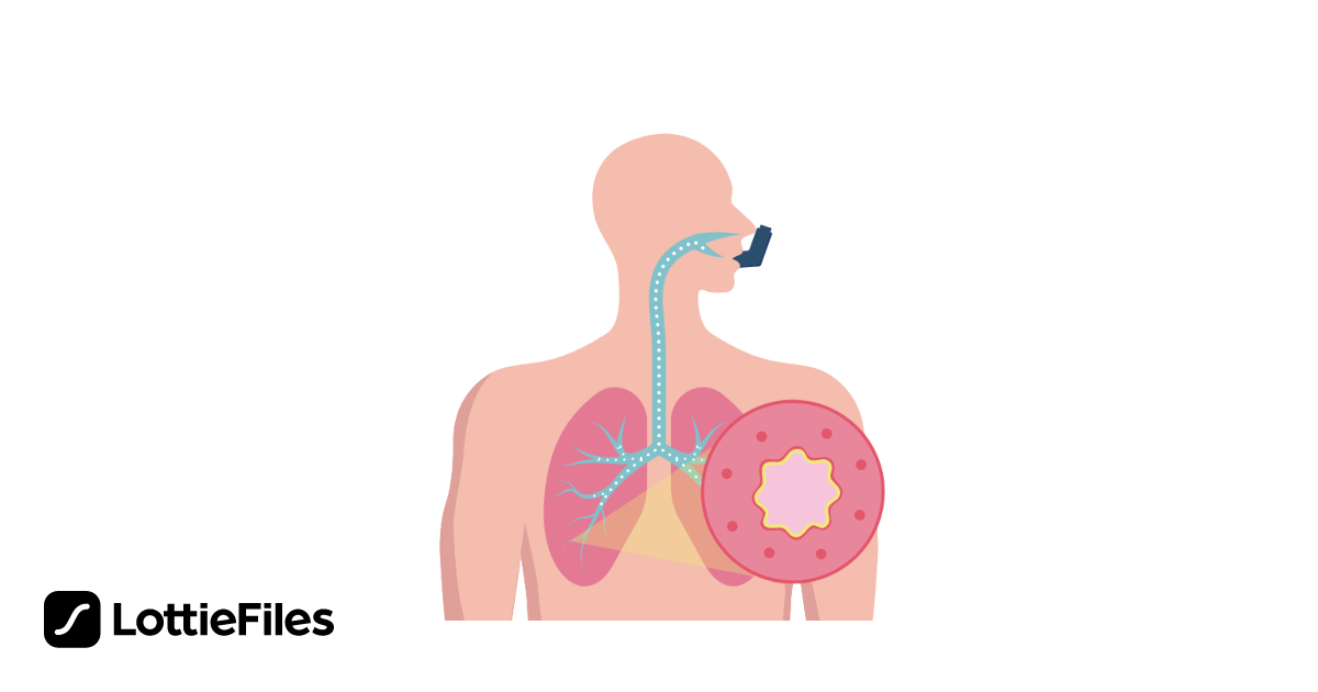 Animación gratuita de COPD Inhaler therapy por Jaimy Bouwman | LottieFiles