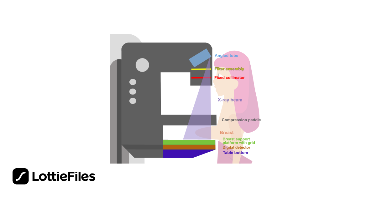 Free Mammography Animation by Joana Barreira | LottieFiles