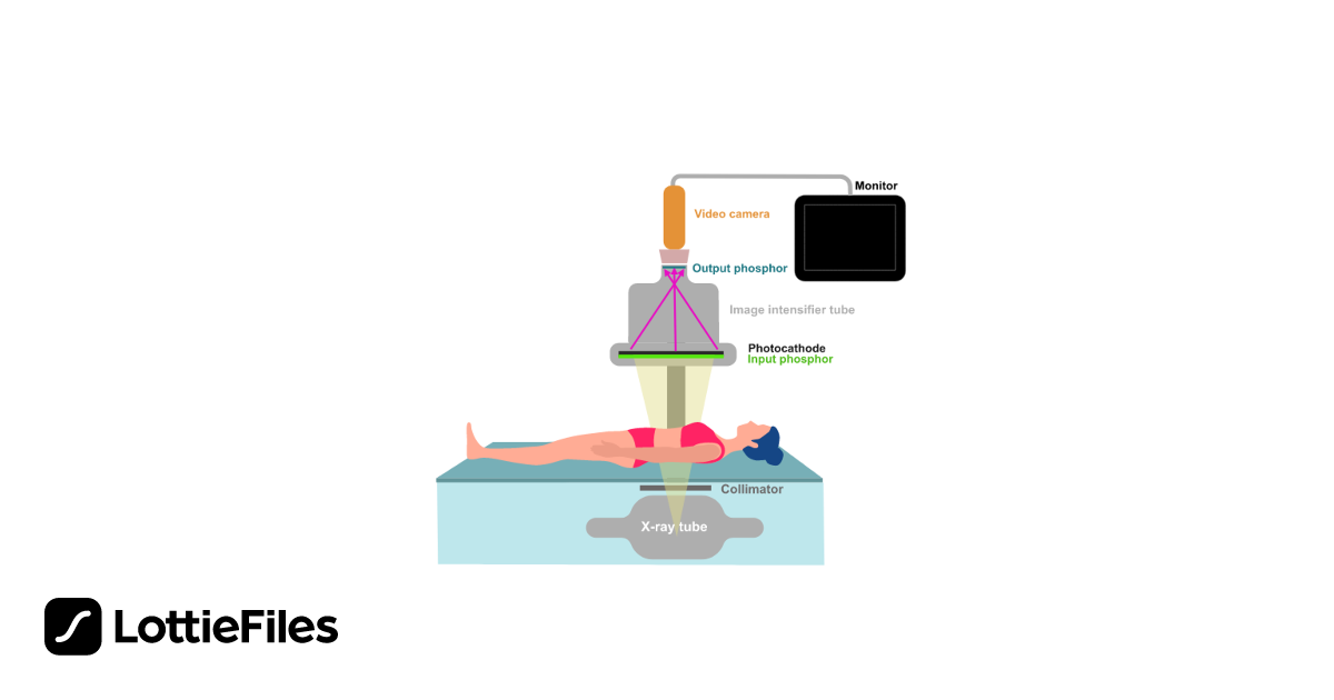 Free Fluoroscopy general labelling Animation by Joana Barreira ...
