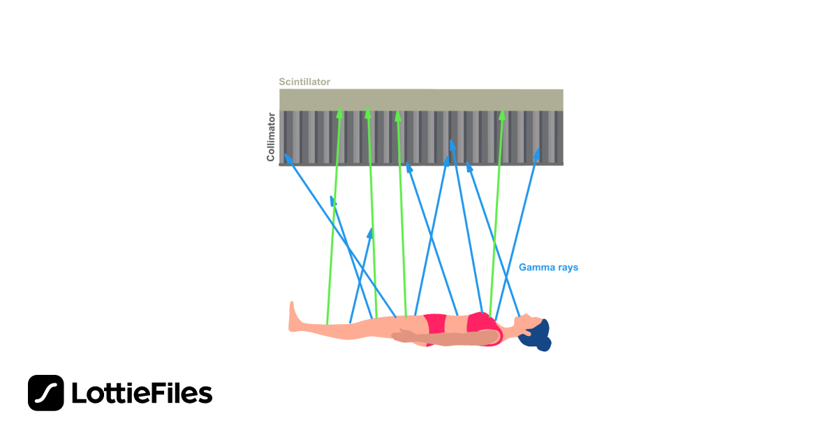 Joana Barreira의 무료 Gamma Camera Collimator 애니메이션 로티파일