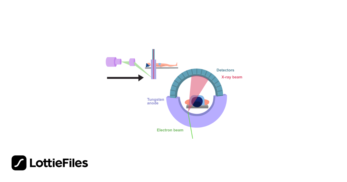 CT advanced electron beam scanner by Joana Barreira - LottieFiles