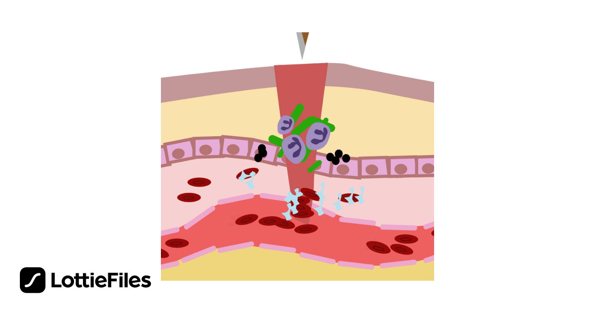 Free Inflammation swelling Animation by Joana Barreira | LottieFiles