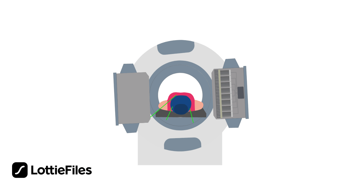 Free Gamma camera general how it works Animation by Joana Barreira ...