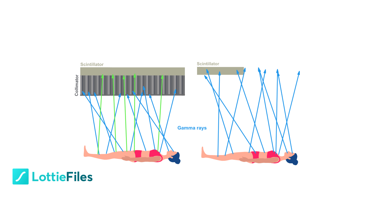 With And Without Collimator Gamma Camera By Joana Barreira Lottiefiles