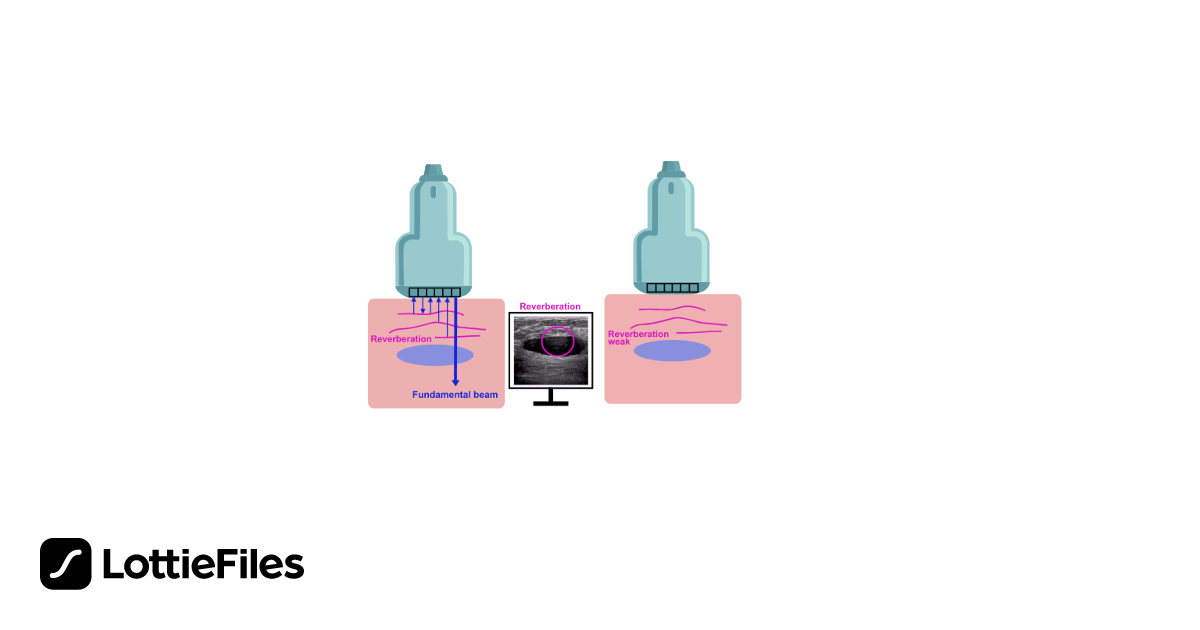 Free Ultrasound imaging harmonic Animation by Joana Barreira | LottieFiles