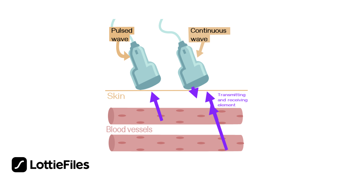 Free transducer Animation by Mervin Paul | LottieFiles