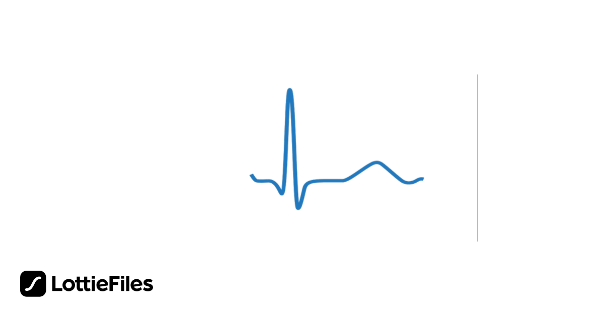 Free blue ECG line Animation by Roland Pálinkás | LottieFiles