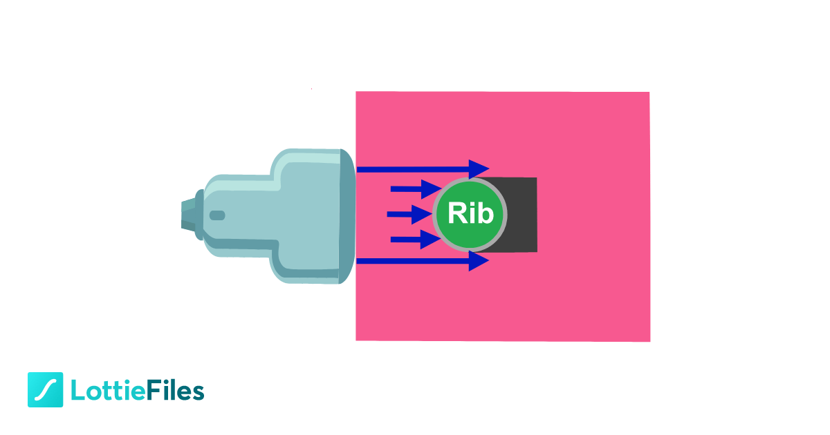 Acoustic shadowing artefact ultrasound by Joana Barreira - LottieFiles