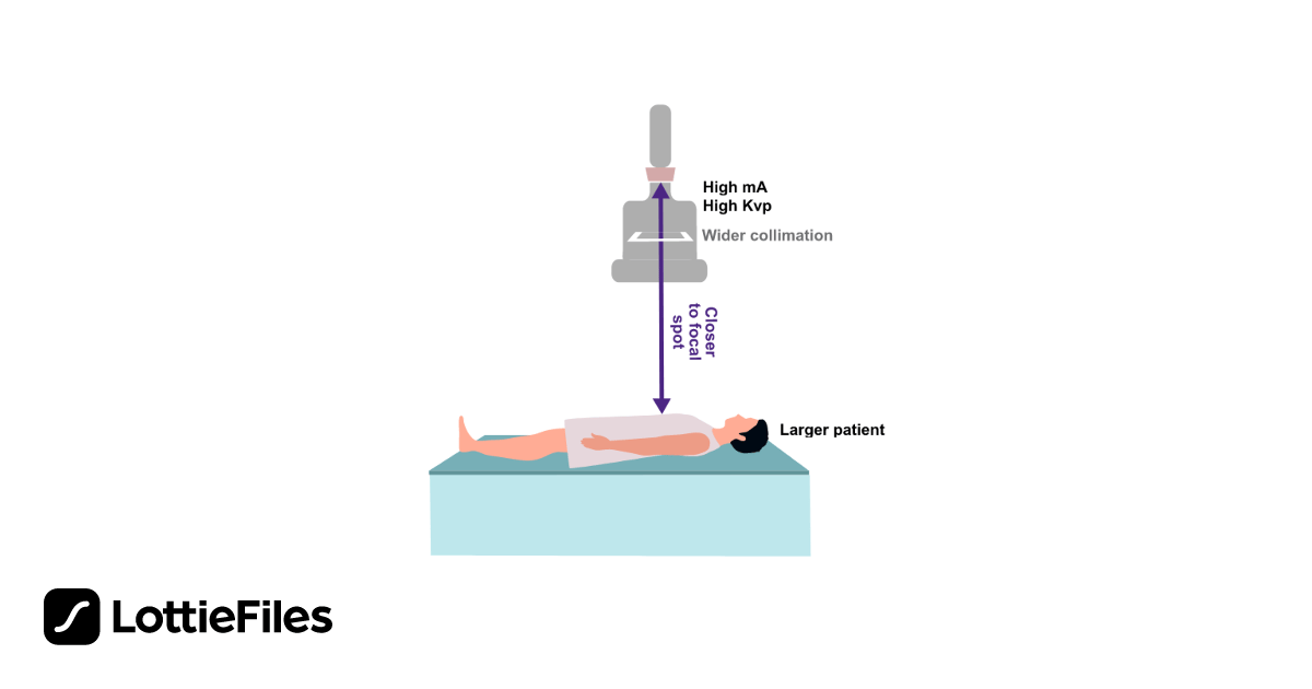 Free Patient dosimetry - Increased dose radiation Animation by Joana ...