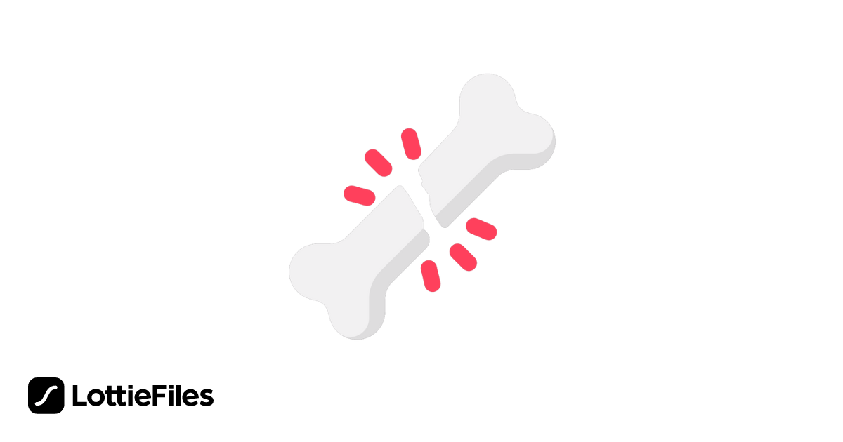 Free Bone Fracture-Lottie animation Animation by Aswathy J | LottieFiles