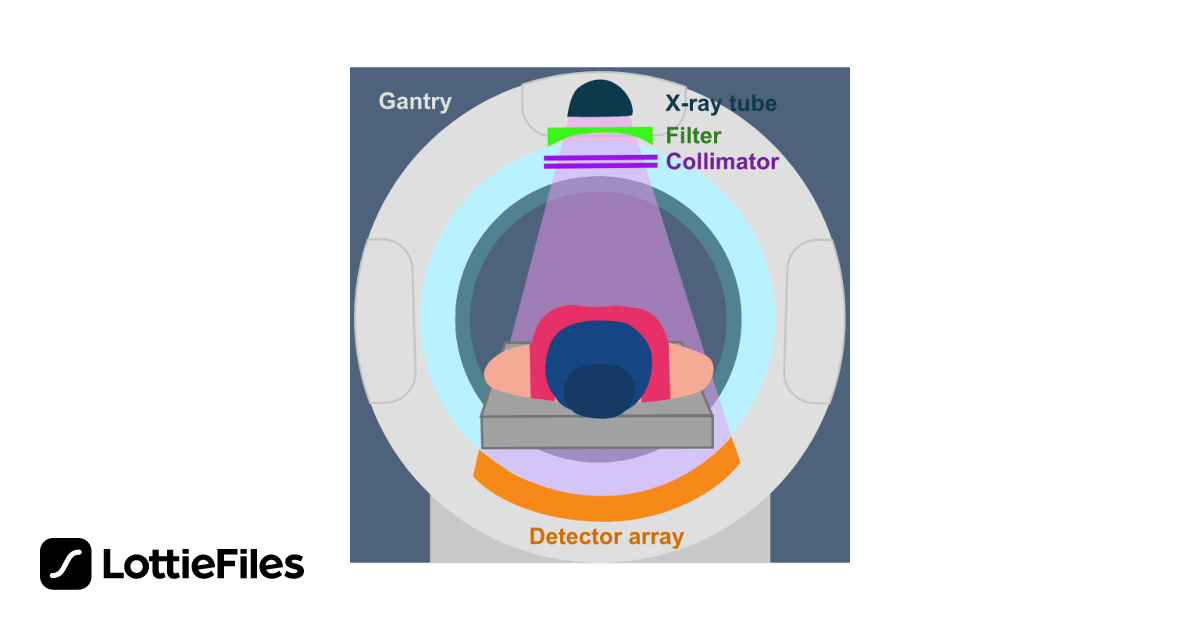 Free CT components labelling Animation by Joana Barreira | LottieFiles