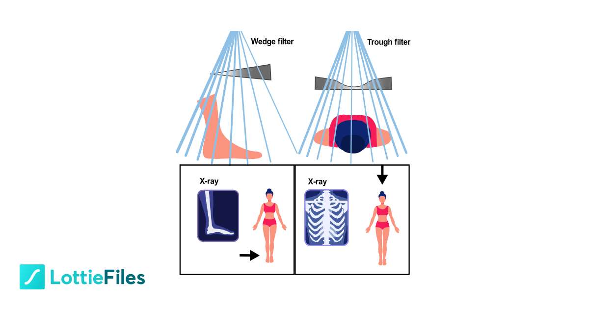 Compensating filter CT - new by Joana Barreira - LottieFiles