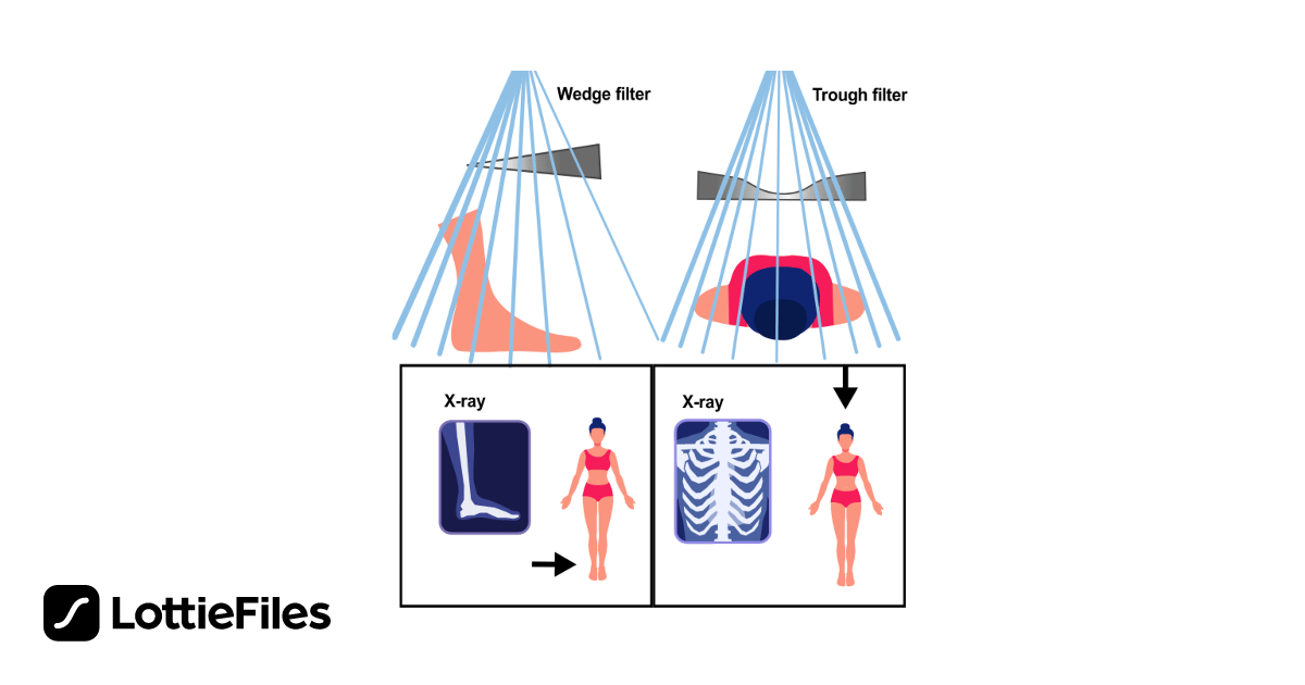 Free Compensating filter CT - new Animation by Joana Barreira | LottieFiles
